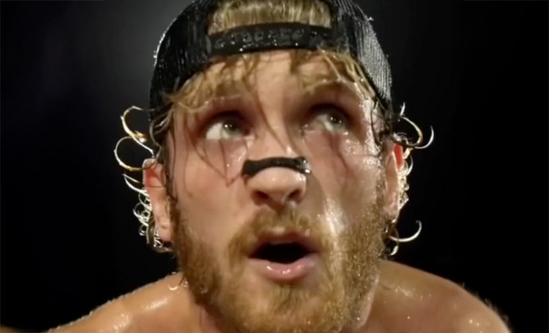 Unmasking Logan Paul’s Secret: What’s That Black Band on His Nose ...