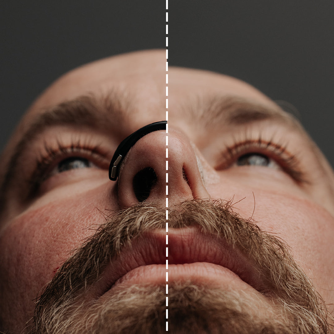 Provides Support for Nasal Structure