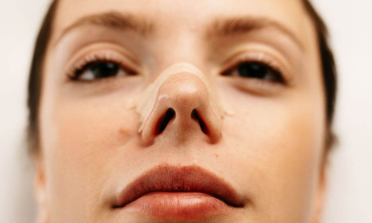 Nasal Strip